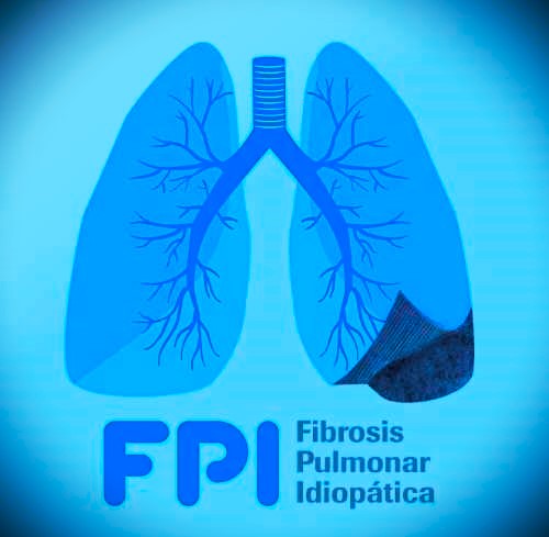 Cada 7 de septiembre se conmemora el Día Mundial de la Fibrosis ...